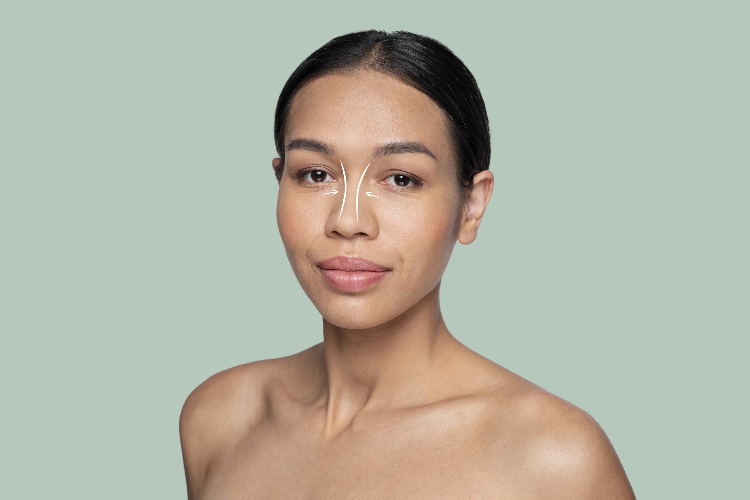 Rinoplastia Estruturada: a importância dos enxertos cartilaginosos - Dr ...